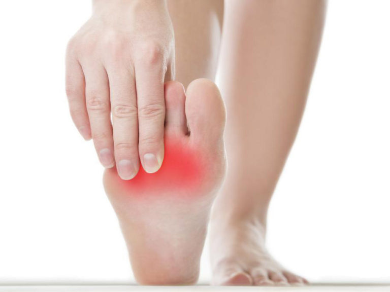 El heloma plantar y su tratamiento mediante la quiropodia - Gelci